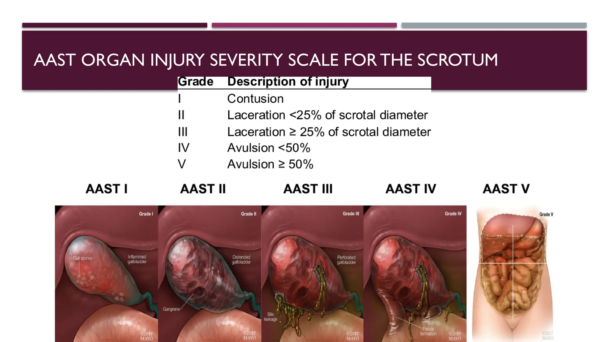 Trauma testicular Y TORCION TESTICULAR.pptx