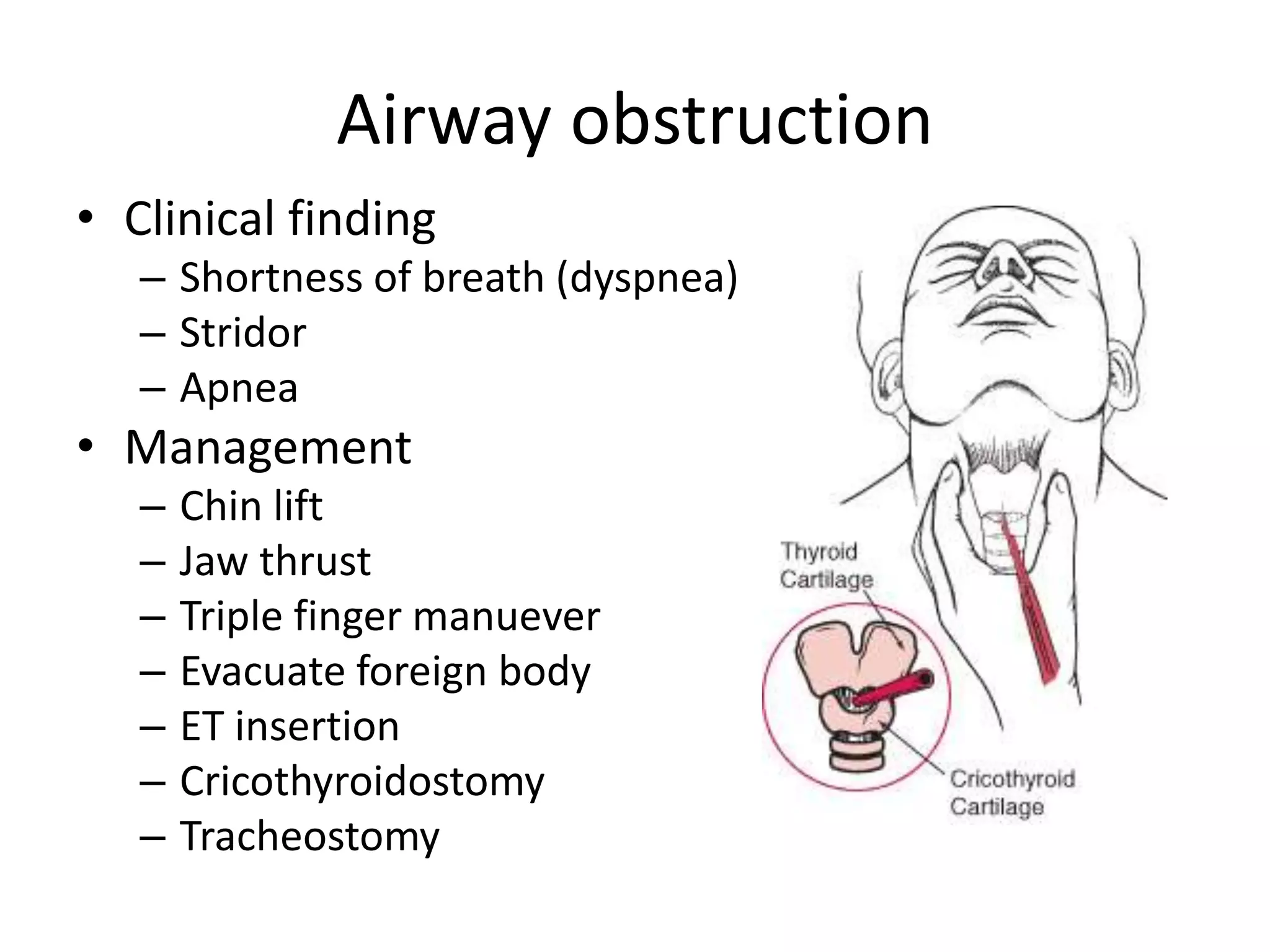 Trauma Thoraks.ppt