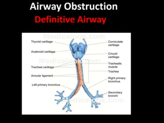 TRAUMA THORAKS DR TAW RSPAD1.ppt