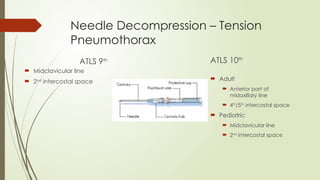 TRAUMA THORAX ATLS MTE untuk tindakan bedah.pptx