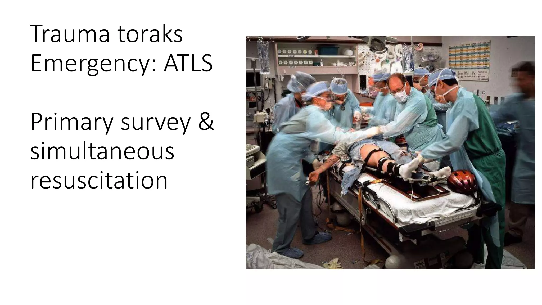 Trauma Thorax fix.donny.pptx
