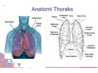 TRAUMA THORAX emergency and how to manage it | PPTX