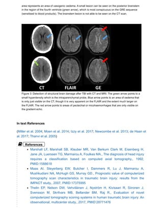 traumatic brain injury in detailed material | PDF