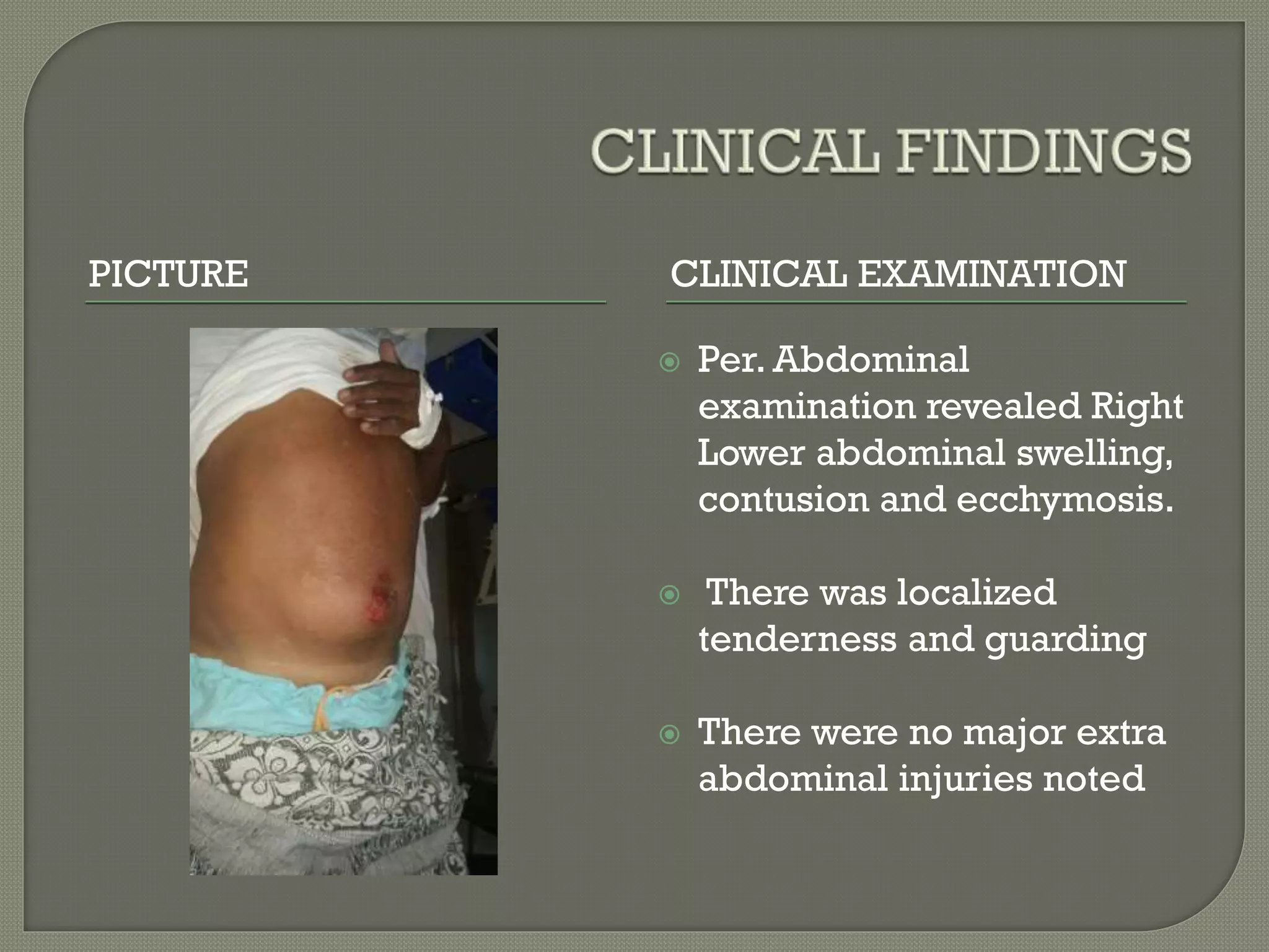 Traumatic abdominal wall hernia ,rare case.pptx 1 | PPTX