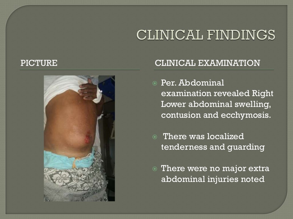 Traumatic abdominal wall hernia ,rare case.pptx 1