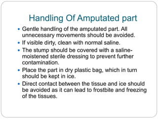 Traumatic amputations | PPTX