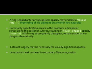 Traumatic and complicated cataract | PPTX
