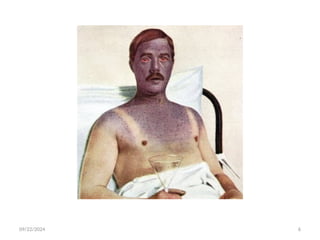 Traumatic and sexual asphyxia Forensic Medicine | PPTX