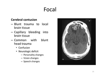 Physiotherapy assessment Traumatic brain injury | PPTX
