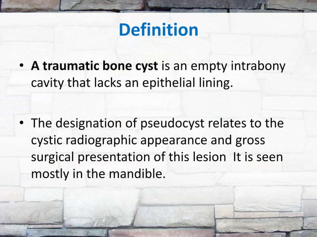Traumatic bone cyst | PPTX