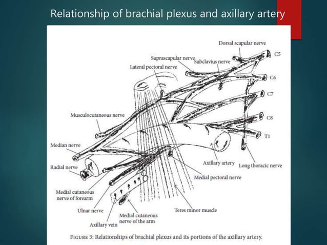 Traumatic brachial plexus injury | PPTX | Death, Injury, or Military Conflict | Sensitive Topics