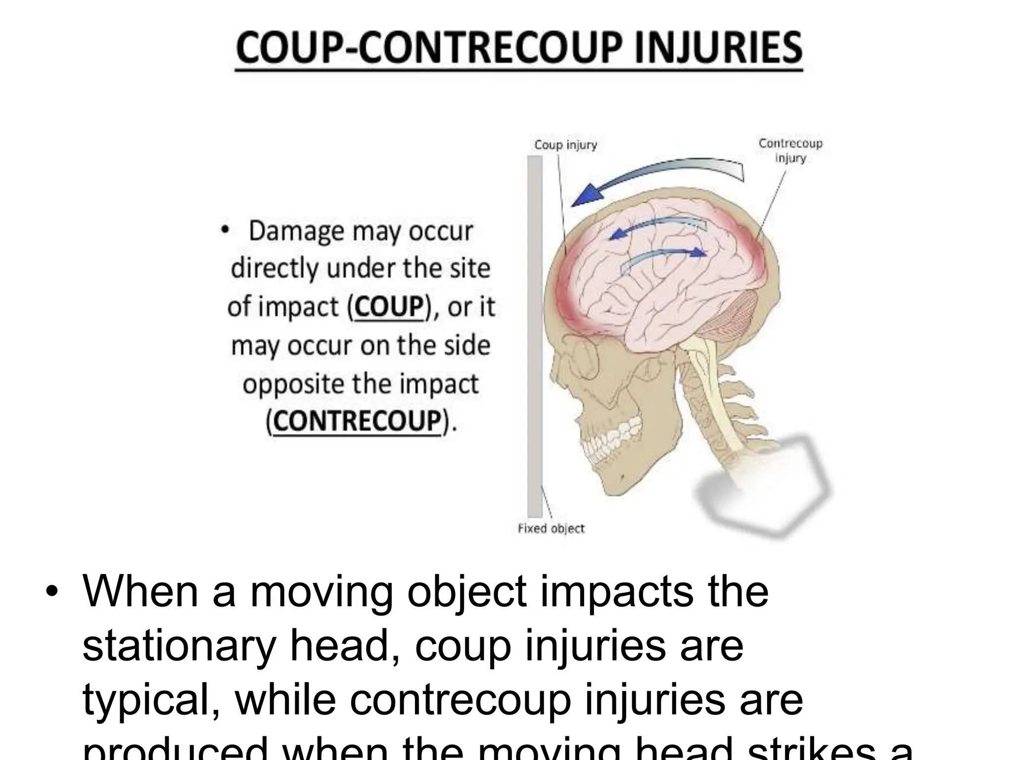 Traumatic brain injuries.ppt