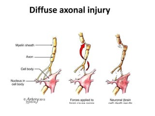 Traumatic brain injuries.ppt