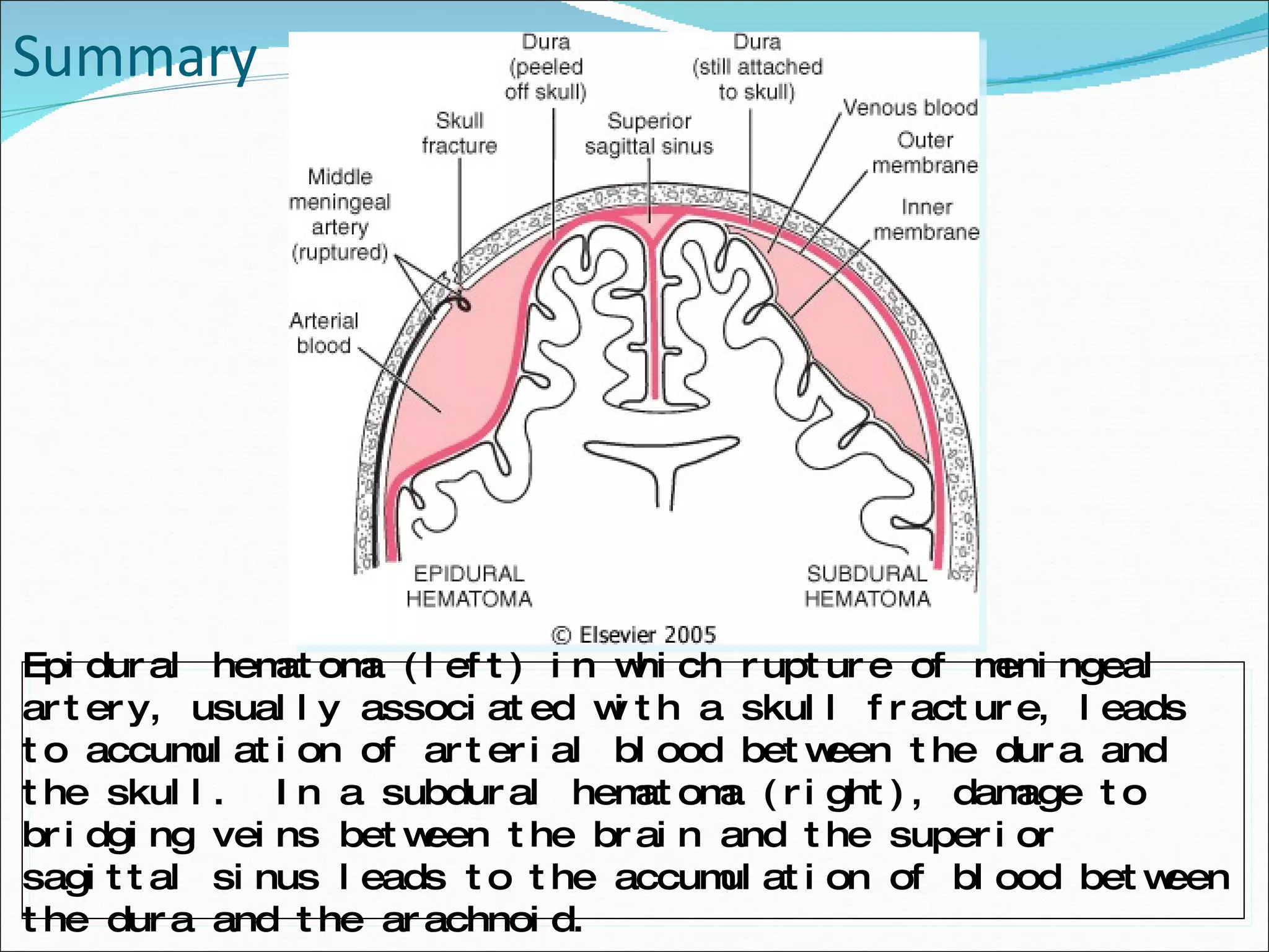 Traumatic brain injury | PPT