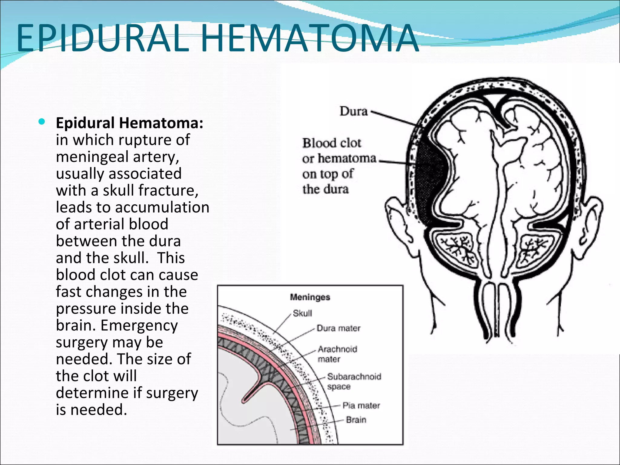 Traumatic brain injury | PPT