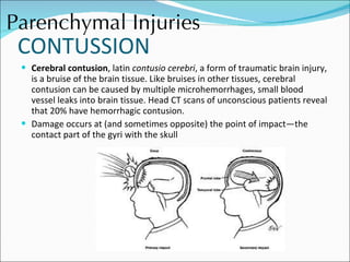 Traumatic brain injury | PPT