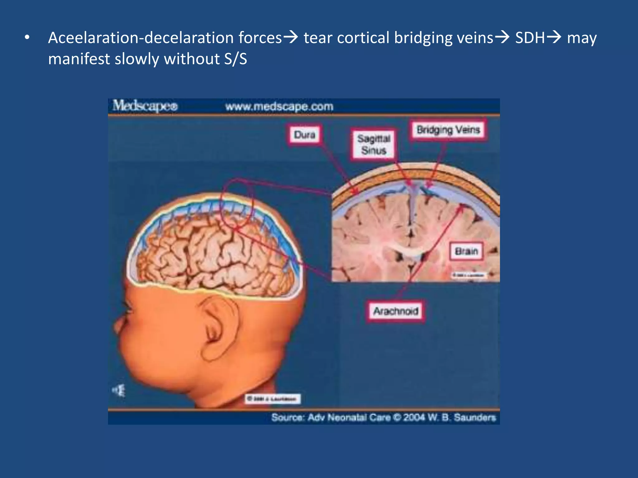 Traumatic brain injury | PPTX