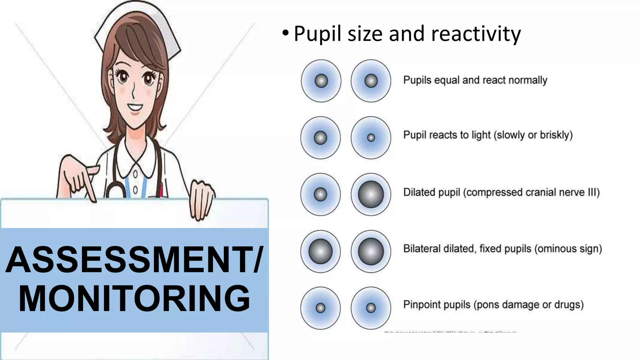 Nursing Management for Traumatic Brain Injury (TBI) | PPTX
