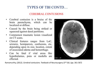 Traumatic Brain Injury | PPTX