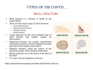 Traumatic Brain Injury | PPTX