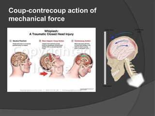 Traumatic Brain Injury.pptx