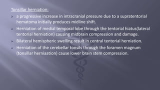 Traumatic brain injury | PPTX