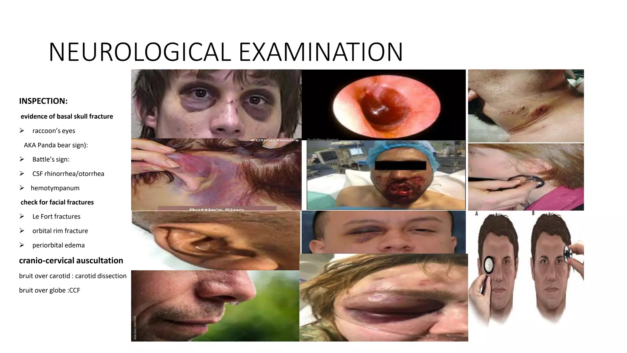 TRAUMATIC BRAIN INJURY - Copy.pptx