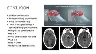 TRAUMATIC BRAIN INJURY - Copy.pptx