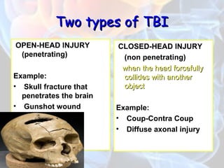 Traumatic brain injury | PPT