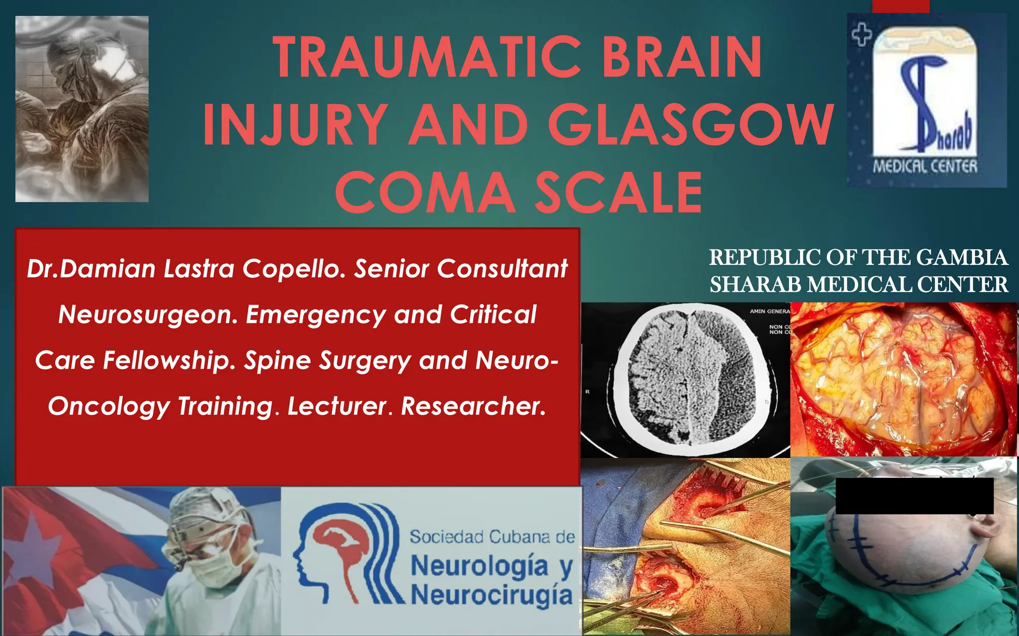 TRAUMATIC BRAIN INJURY AND GLASGOW COMA SCALE.DR. DAMIAN LASTRA COPELLO ...