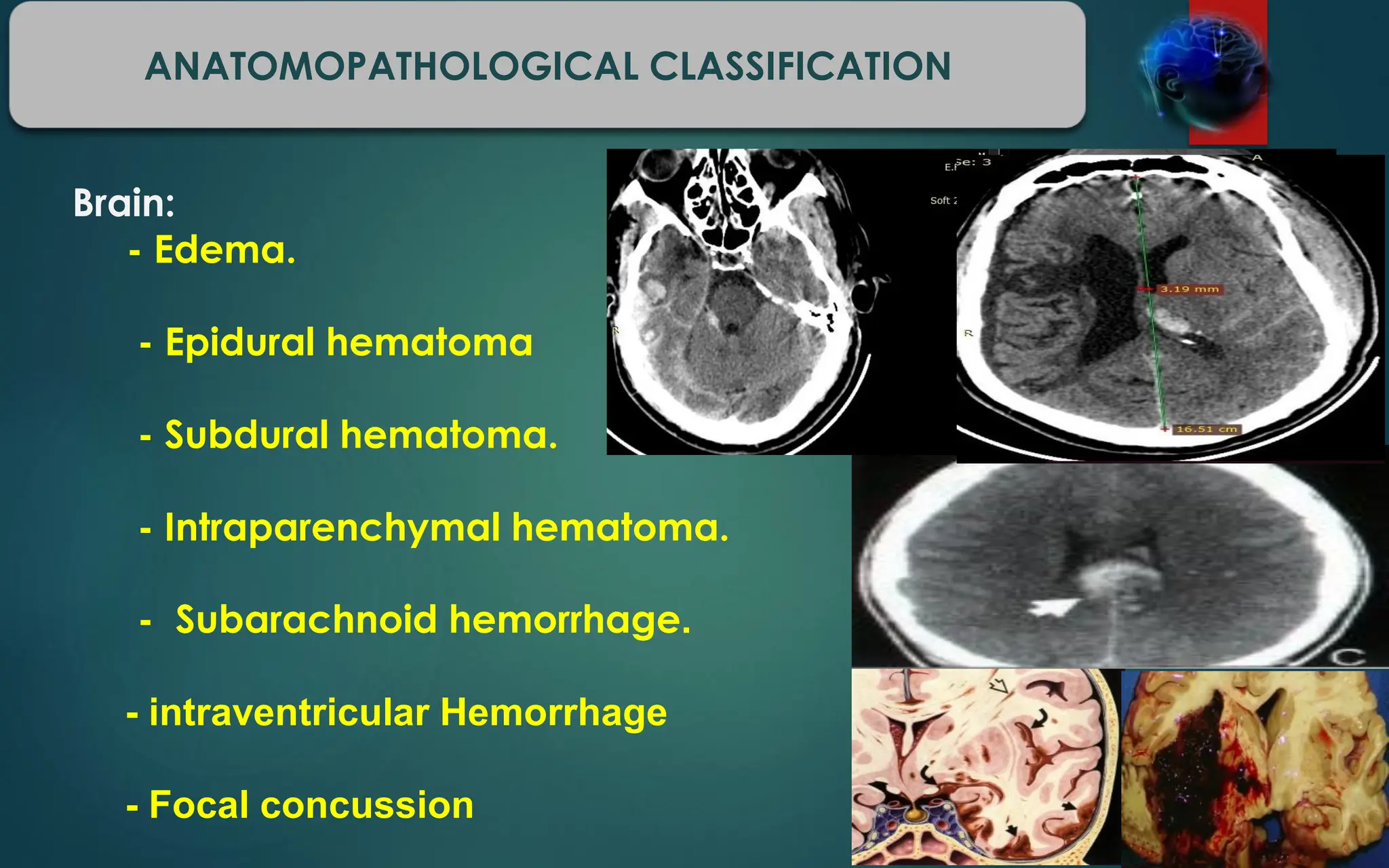 TRAUMATIC BRAIN INJURY AND GLASGOW COMA SCALE.DR. DAMIAN LASTRA COPELLO ...