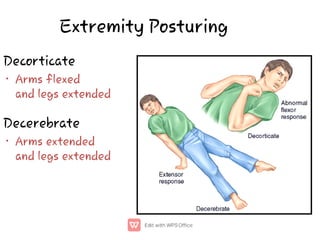 Abnormal Posturing Brain Injury