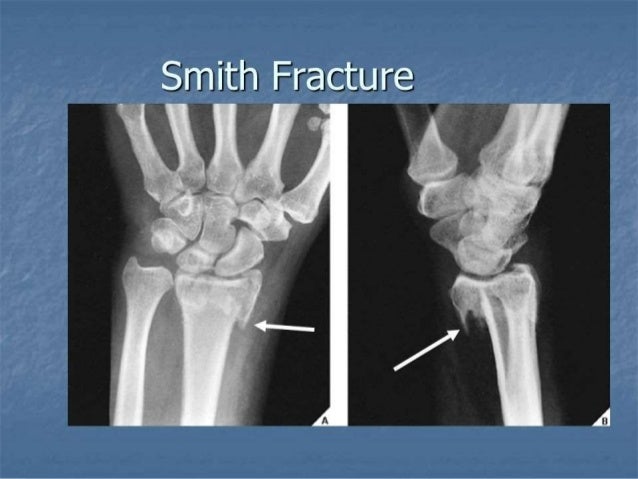 Traumatic case in orthopedic