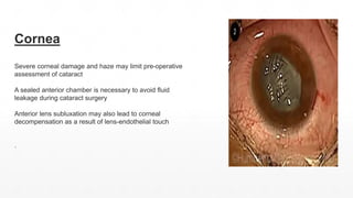 Traumatic Cataract.pptx