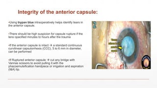Traumatic Cataract.pptx