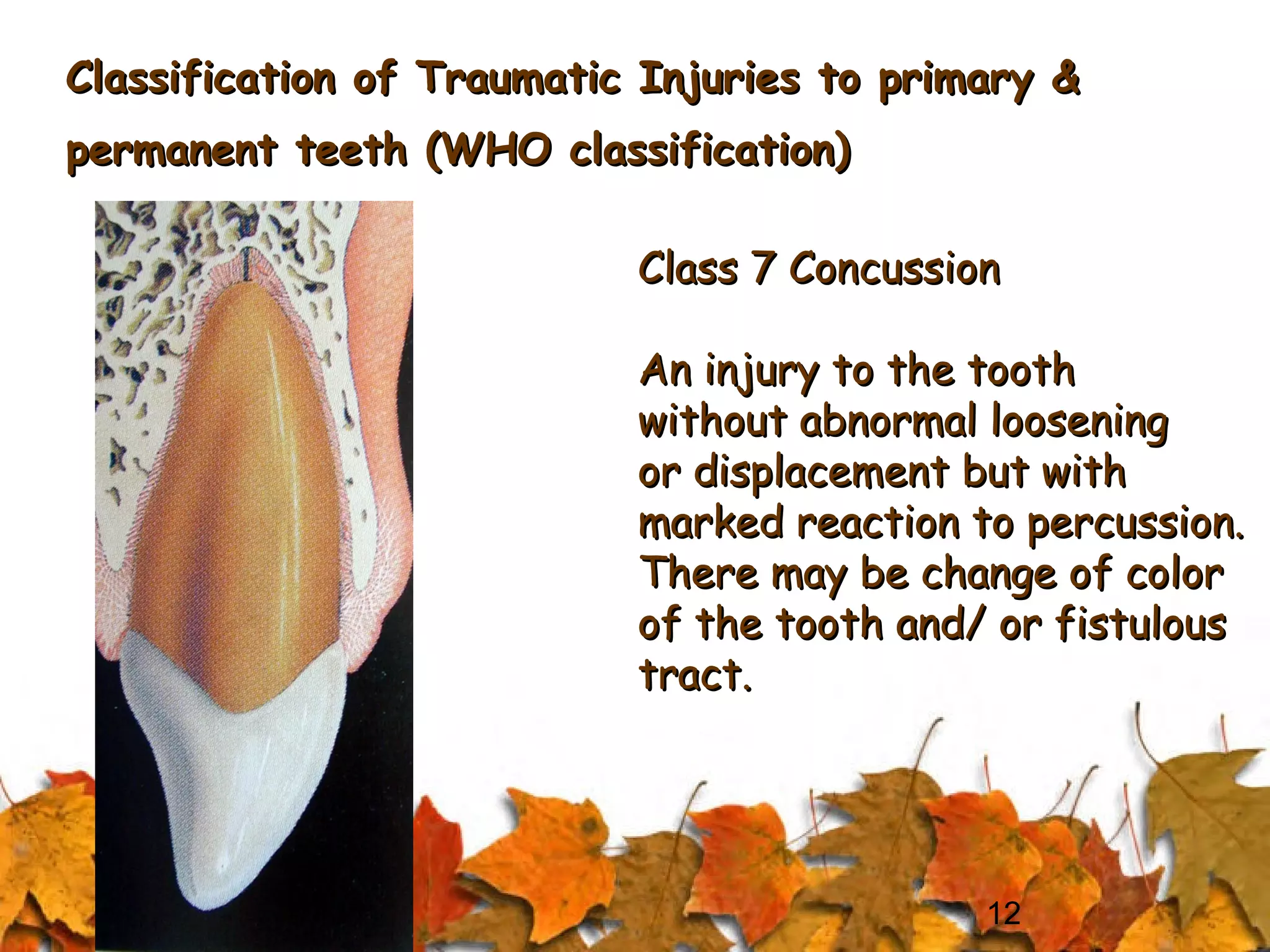 Classification of traumatic Injuries to anterior teeth of children | PPT