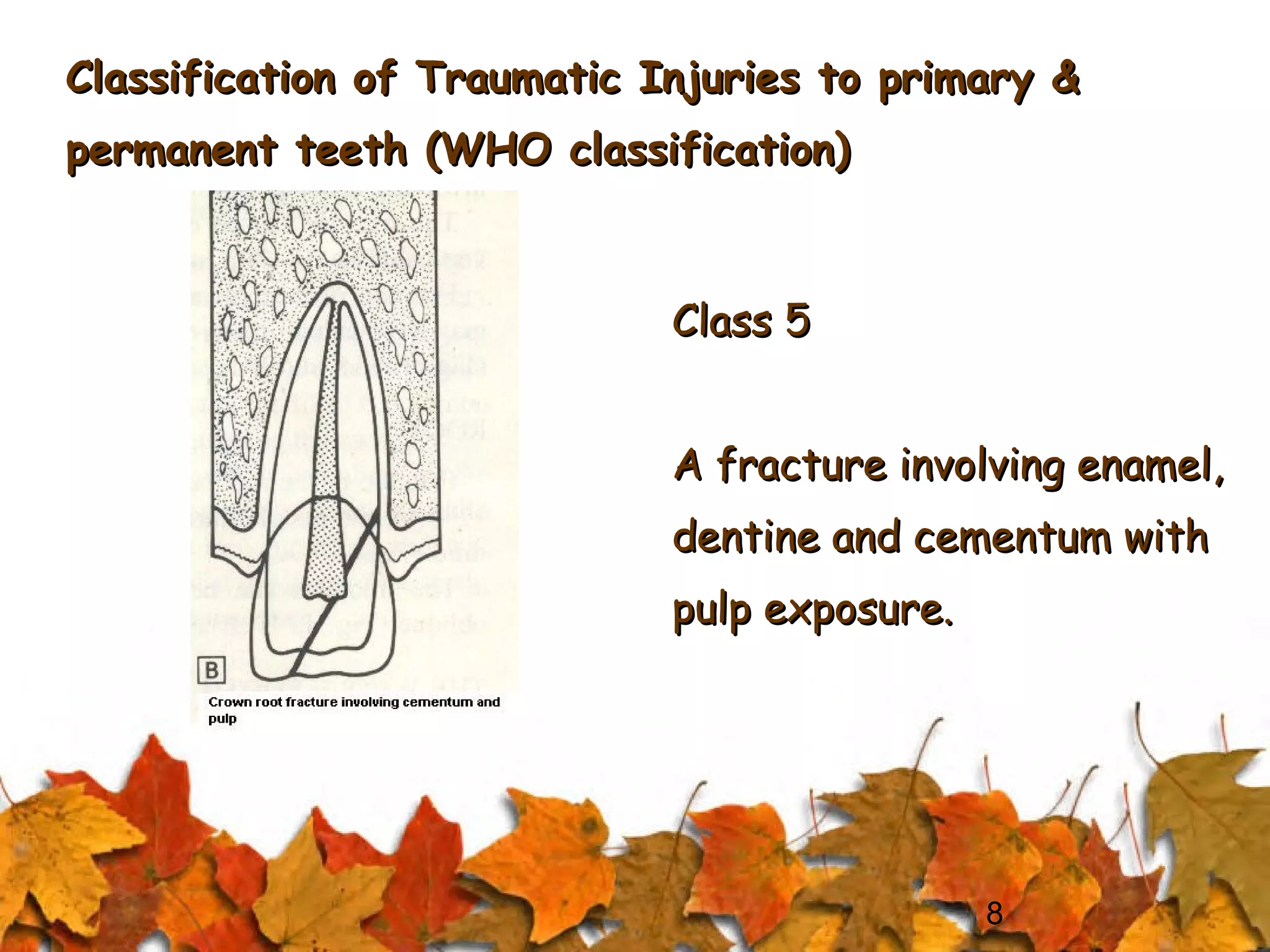 Classification of traumatic Injuries to anterior teeth of children | PPT