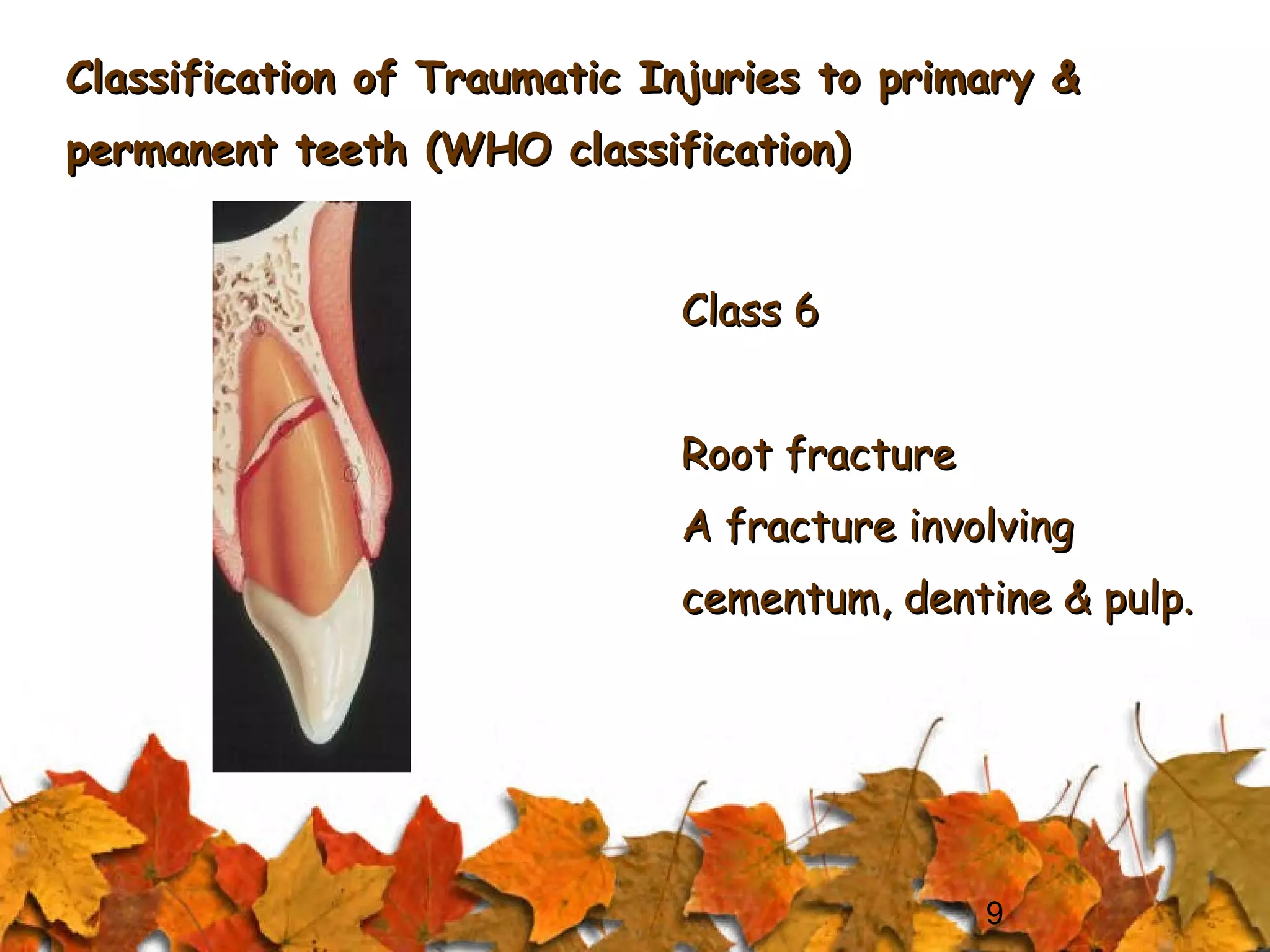 Classification of traumatic Injuries to anterior teeth of children | PPT