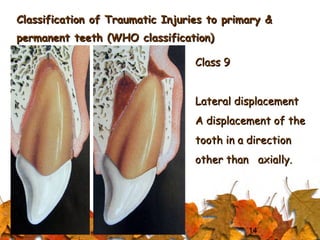 Classification of traumatic Injuries to anterior teeth of children | PPT