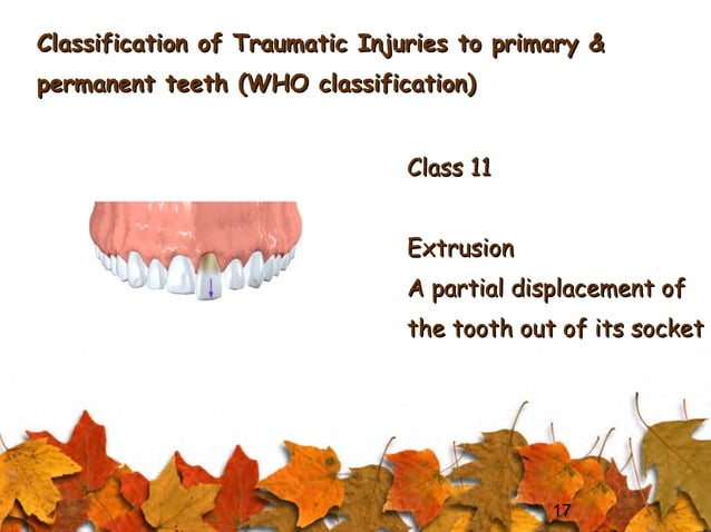 Classification of traumatic Injuries to anterior teeth of children | PPT