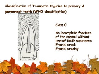 Classification of traumatic Injuries to anterior teeth of children | PPT