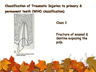 Classification of traumatic Injuries to anterior teeth of children | PPT