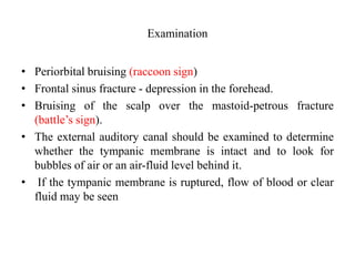 Traumatic csf fistula.pptx