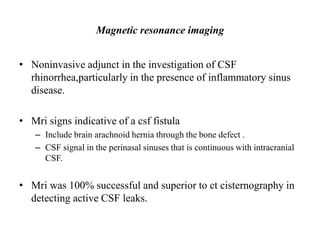 Traumatic csf fistula.pptx