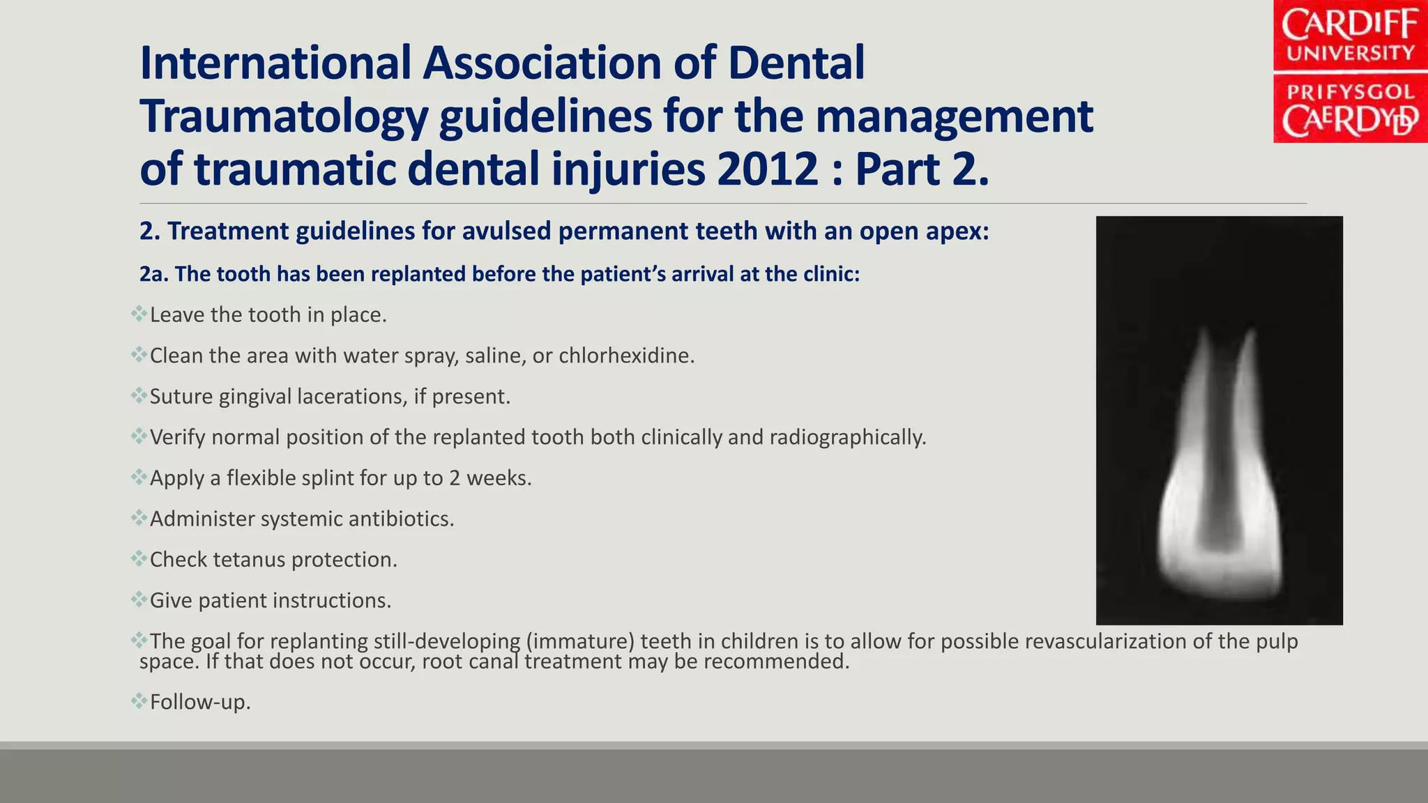 Traumatic dental injuries | PPTX