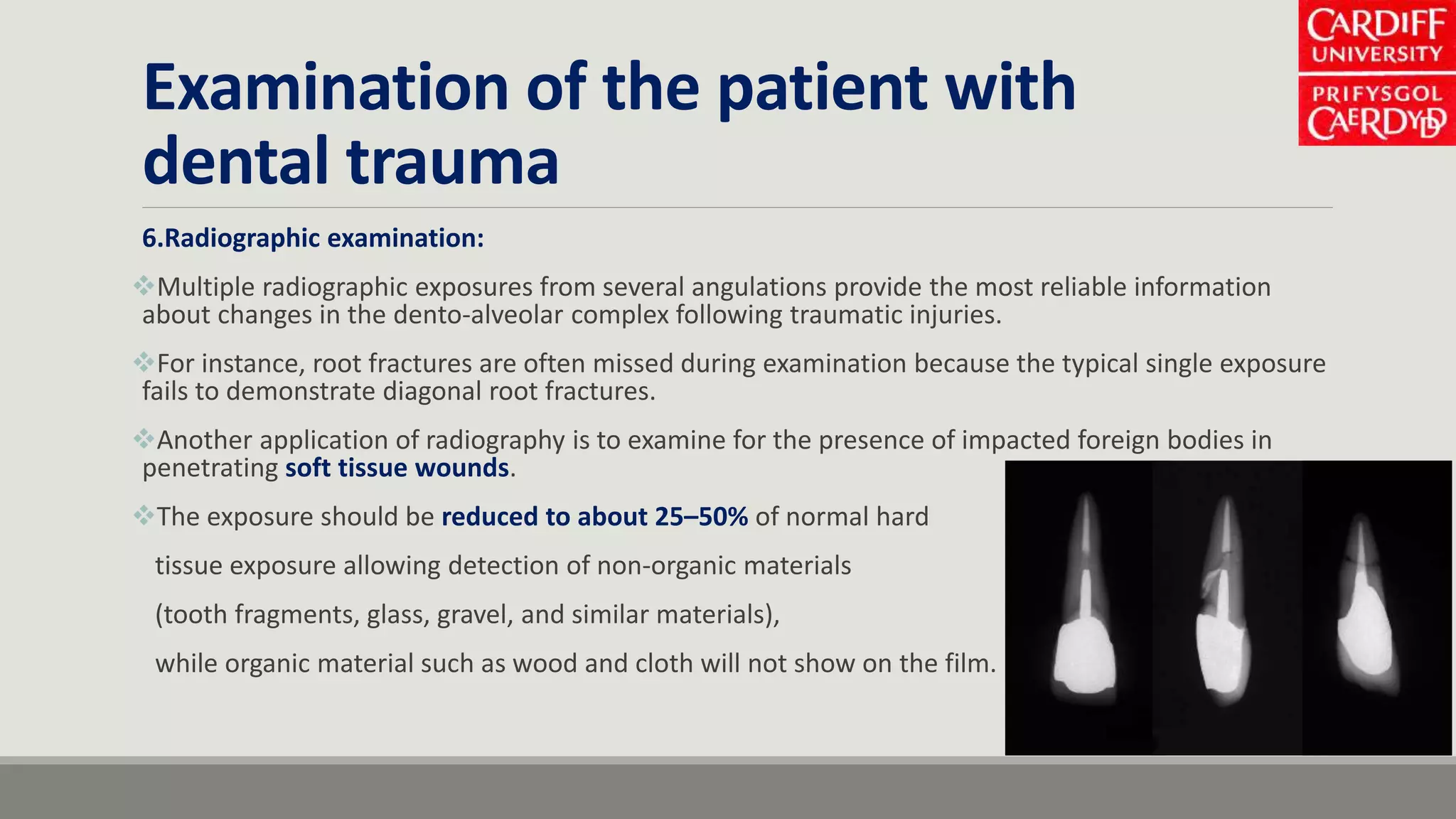 Traumatic dental injuries | PPTX