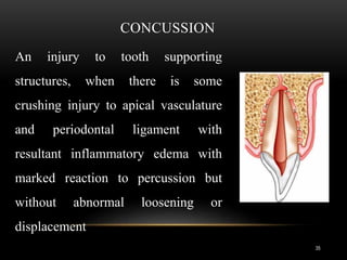 Traumatic dental injuries | PPT