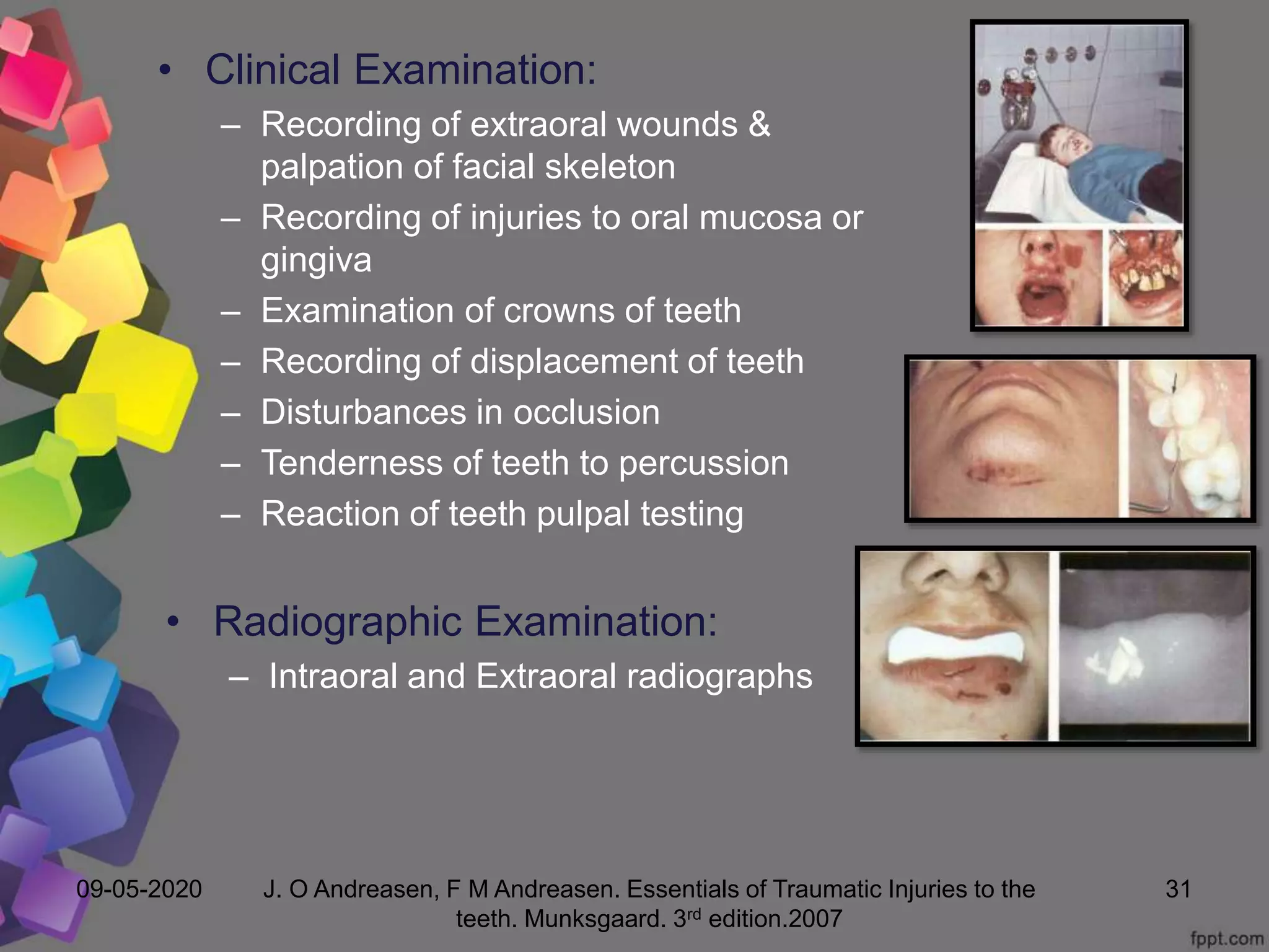 Traumatic Dental Injuries to Permanent Teeth | PPT