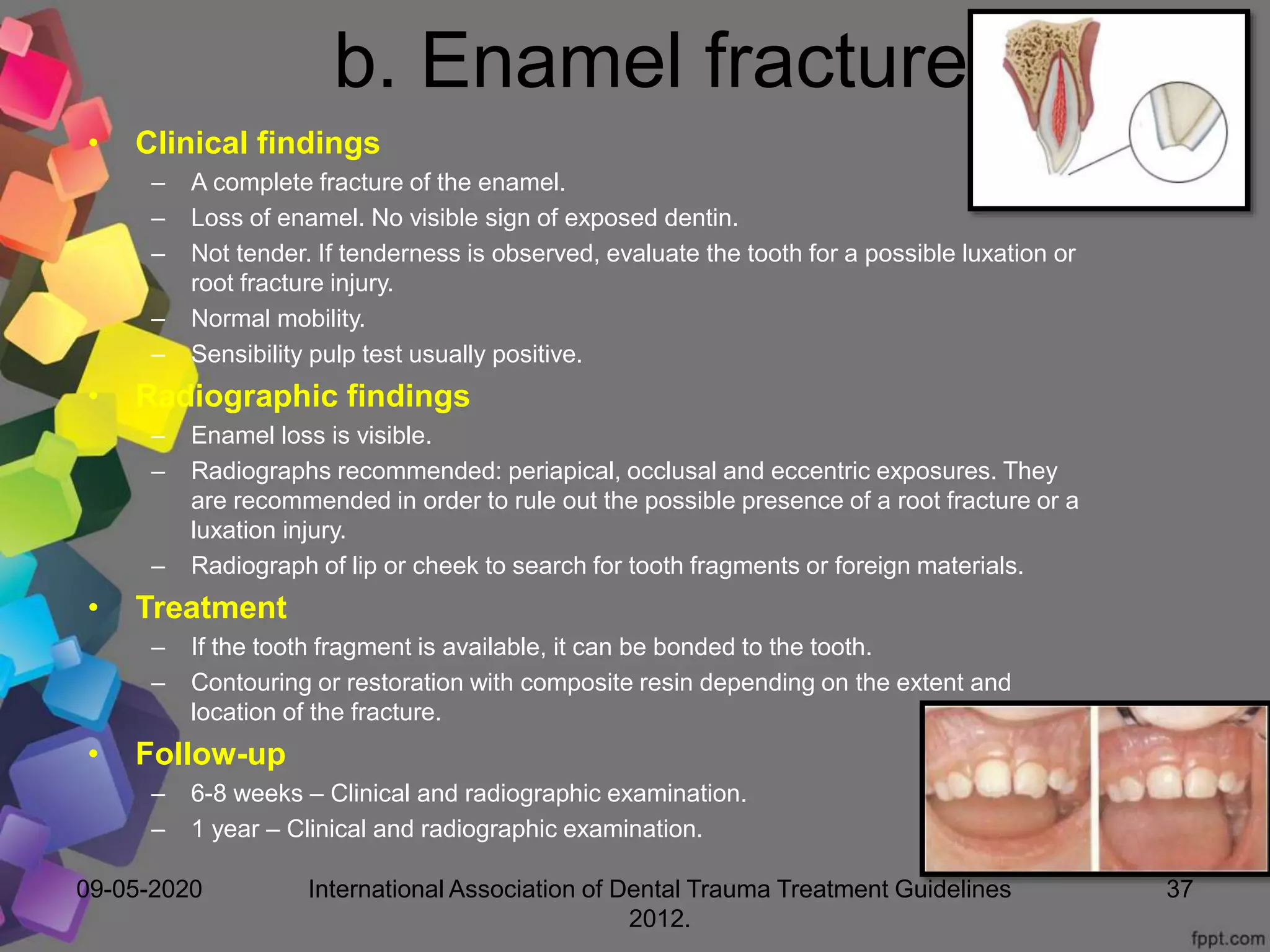 Traumatic Dental Injuries to Permanent Teeth | PPT