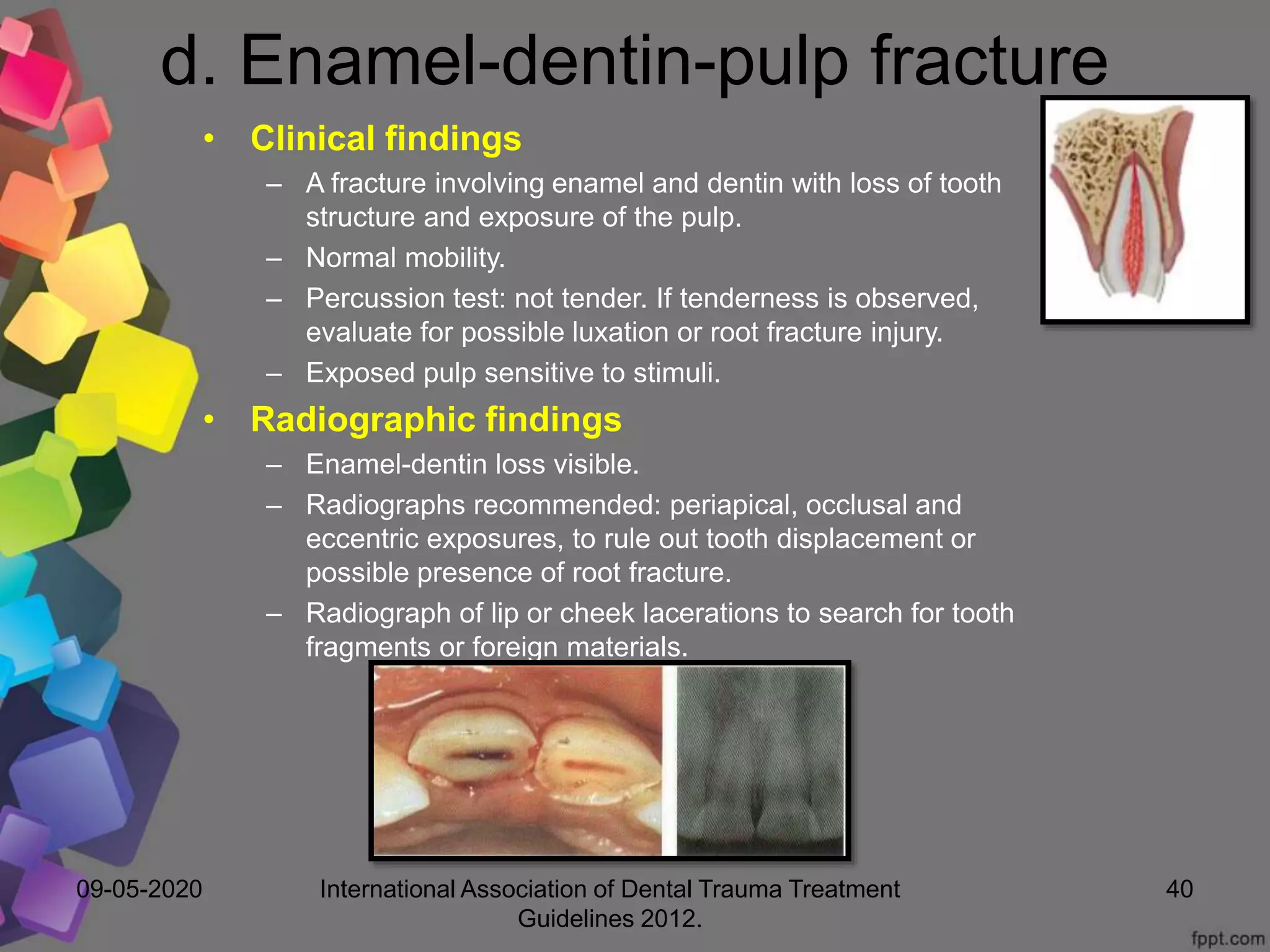 Traumatic Dental Injuries to Permanent Teeth | PPT